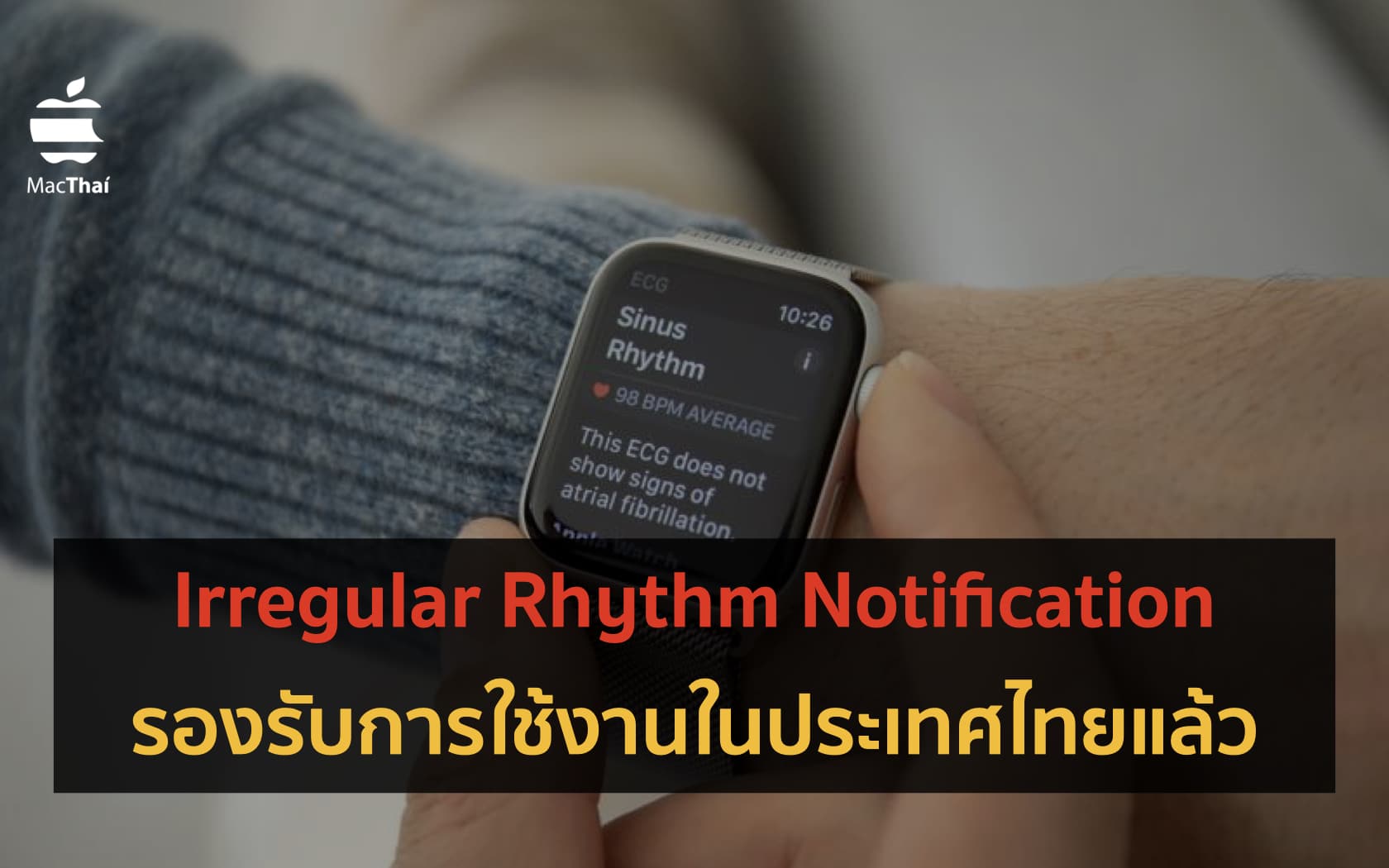 Apple Watch รองรับการใช้งาน Irregular Rhythm Notification ในประเทศไทยแล้ว